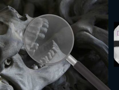 Forensic Dentistry - Drews Dental in Lewiston, ME